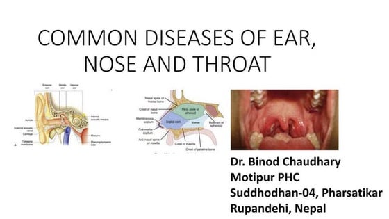 Common Ear Diseases | PDF