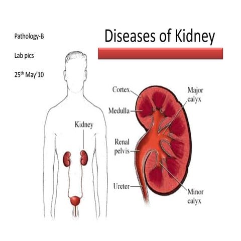 Diseases of kidney patho lab pics | PPTX