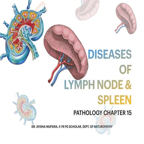 Diseases of Lymph node & Spleen - Pathology | PDF