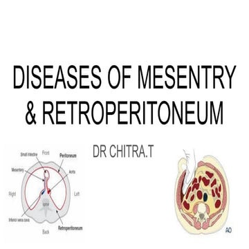 DISEASES OF MESENTRY AND RETROPERITONEUM ESIC MCH General Surgery Unit-3 Prof Chitra.pptx
