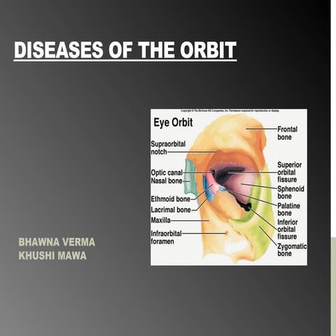 diseases of orbit of eye related concepts | PPTX