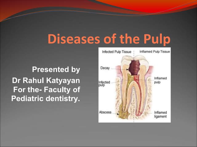 Pulpitis | PPTX