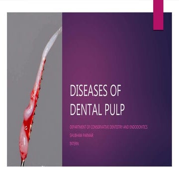 Diseases of pulp | PPTX