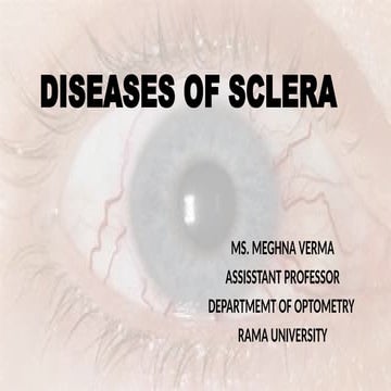 DISEASES OF SCLERA, DISEASES OF SCLERApptx | PPTX