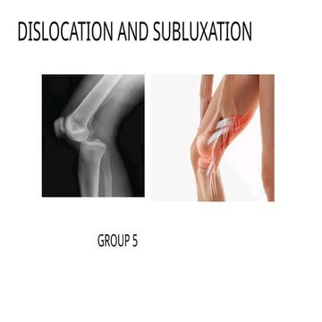 DISLOCATION & SUBLUXATION-BY DAEYANG UNIVERSITY | PPTX
