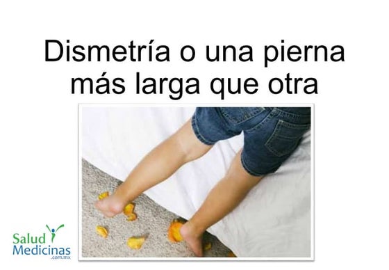 Síndrome de Cherry, qué es y cómo controlarlo... | PPT