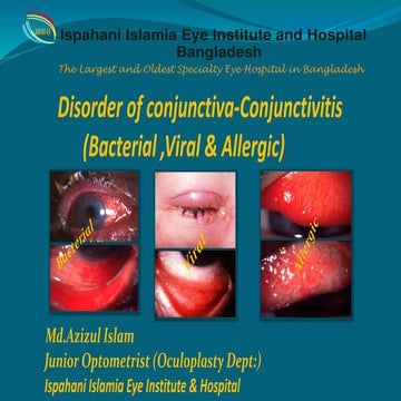 Follicular Conjunctivitis Vs. Papillary Conjunctivitis