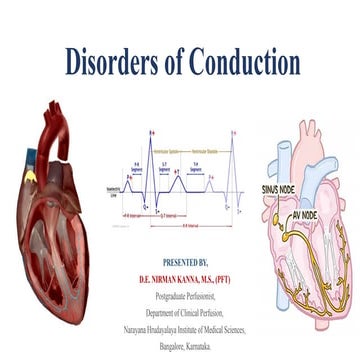 Disorders of Conduction of Heart- Interpretation and Management | PPTX