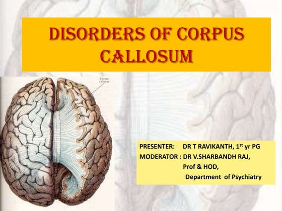 Agenesis of the Corpus Callosum | PDF | Pregnancy | Reproductive Health