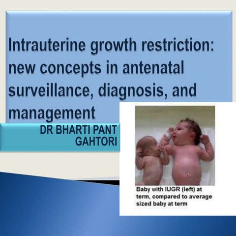 Fetal growth restriction | PPTX