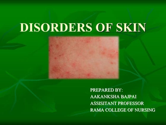 Ophthalmia Neonatorum or Neonatal Conjunctivitis | PPT