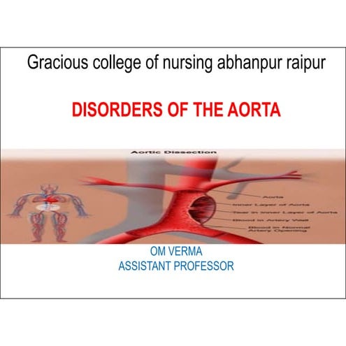 Disorders of the aorta OM VERMA 2022...pdf