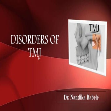 Tmj ankylosis | PPT