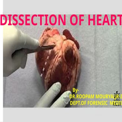 dissection of heart , disease,sample ... | PPTX