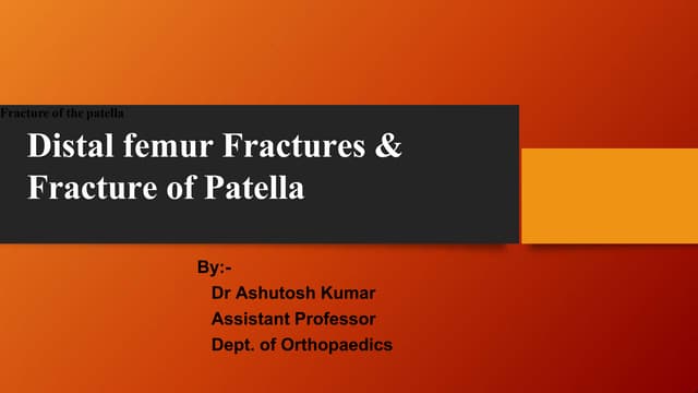 Fracture shaft of tibia | PPTX