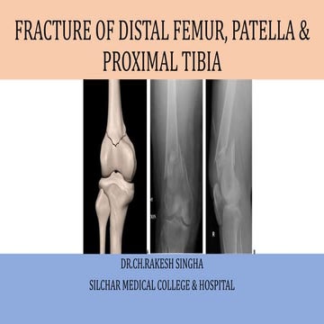 DISTAL FEMUR, PATELLA, PROXIMAL TIBIA FRACTURE.pptx