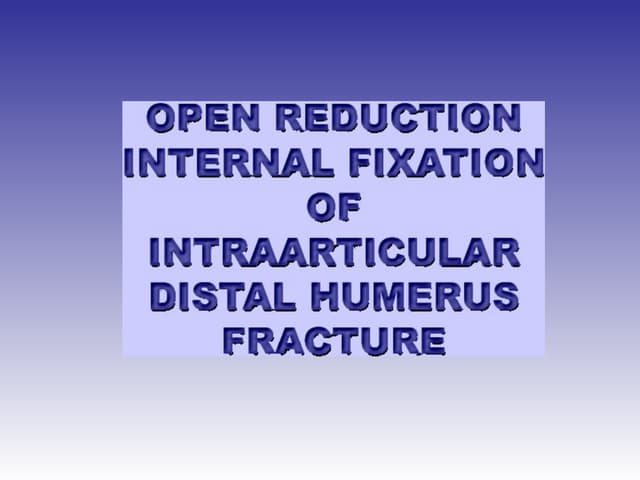 Socket variants in upper extremity prosthesis.pptx1 | PPTX