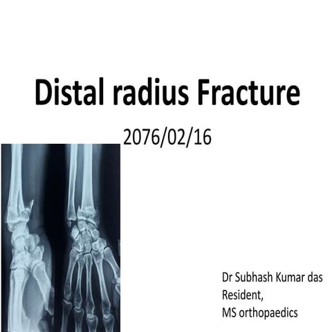 Distal End Radius Fractures - Colles, Smiths & Bartons | PPTX