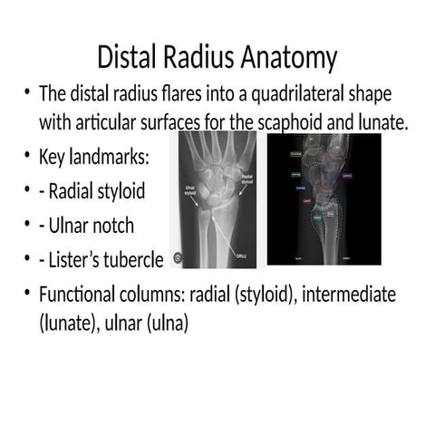 Distal_Radius_Fractures_With_Frykman.pptx