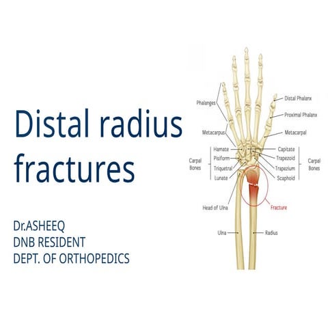 distal radius fractures power point.pptx