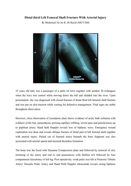 Approach to history taking in internal medicine posting | PDF | Lung ...