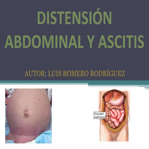 Distensión abdominal y Ascitis | PPTX