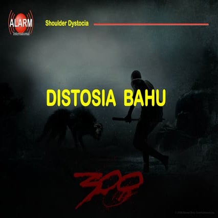 Distosia bahu (Penyulit pada Persalinan) | PPT