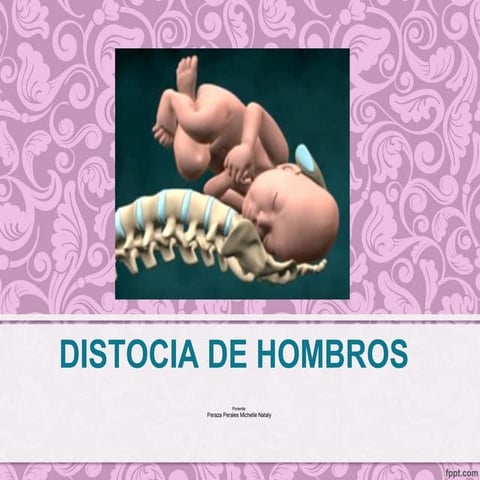 Askep distosia | PDF