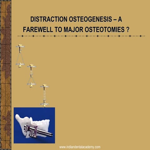 Distraction osteogenesis | PPT