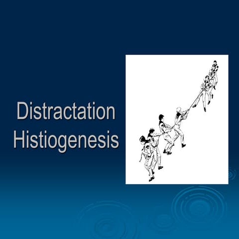 Distraction histogenesis in Ilizarov | PPT