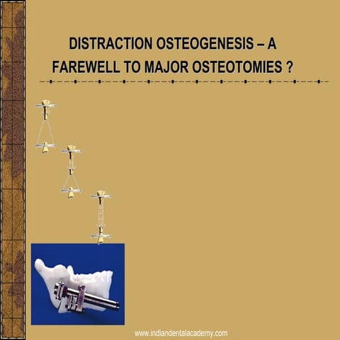 Distraction osteogenesis 1 /certified fixed orthodontic courses by ...