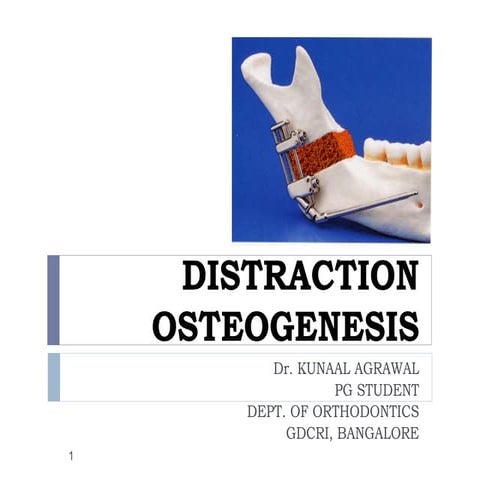 Distraction osteogenesis | PPT