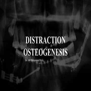 Distraction Osteogenesis- orthodontics.pptx