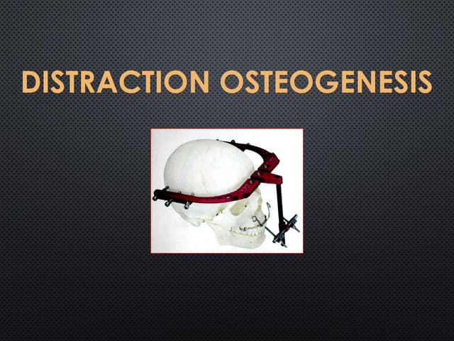 Distraction osteogenesis | PPT
