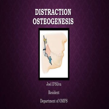 Distraction osteogenesis in maxillofacial surgery | PPTX