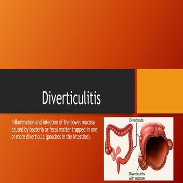 Diverticulitis | PPT