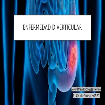 ENFERMEDAD DIVERTICULAR, DIVERTICULOSIS, DIVERTICULITIS | PPTX