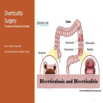 Diverticulitis Surgery Procedure And Recovery Southlake Pdf Free
