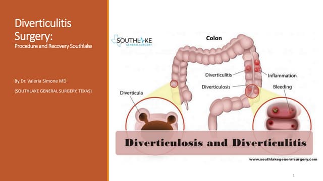 Diverticulitis Surgery Procedure And Recovery Southlake Pdf Free