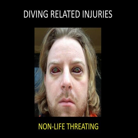 Diving related injuries tex | PPTX