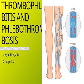 Thrombophlebitis and Phlebothrombosis.pptx