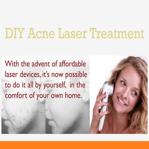 DIY Acne Laser Treatment | PPT