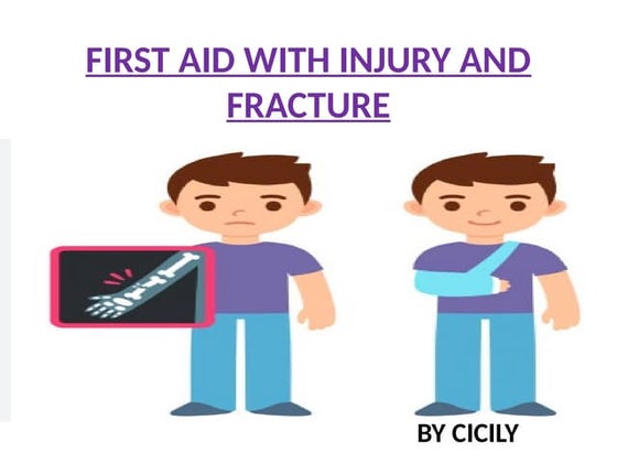 Fracture ................... (1) hala.pptx