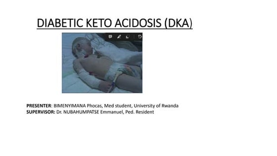 DKA in children | PPT