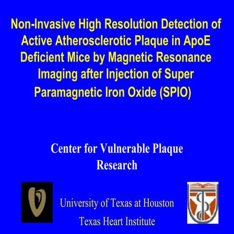 Spio mri studies by dr naghavi | PPT