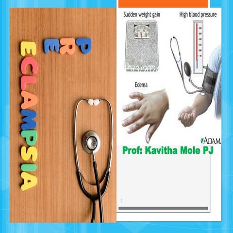 Preeclampsia and eclampsia | PPT