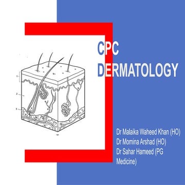 DLE Case Presentation with atypical symptoms | PPTX
