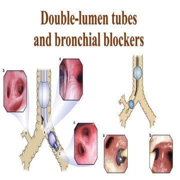 DLT & BB_anaesthesiaequipmentsandpracticle.pptx
