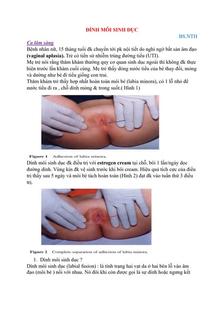 các đường kerley trong x-quang phổi | PDF