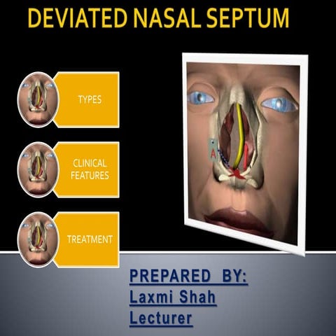 Deviated nasal septum | PPTX